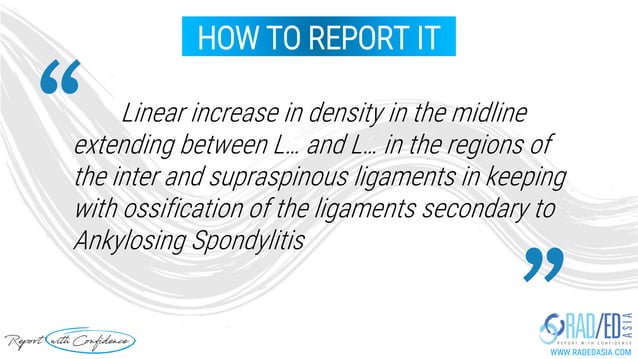 ANKYLOSING SPONDYLITIS SPINE IMAGING DAGGER SIGN RADEDASIA | PDF