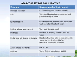 Ankylosing spondylitis treatment and assessment | PPTX