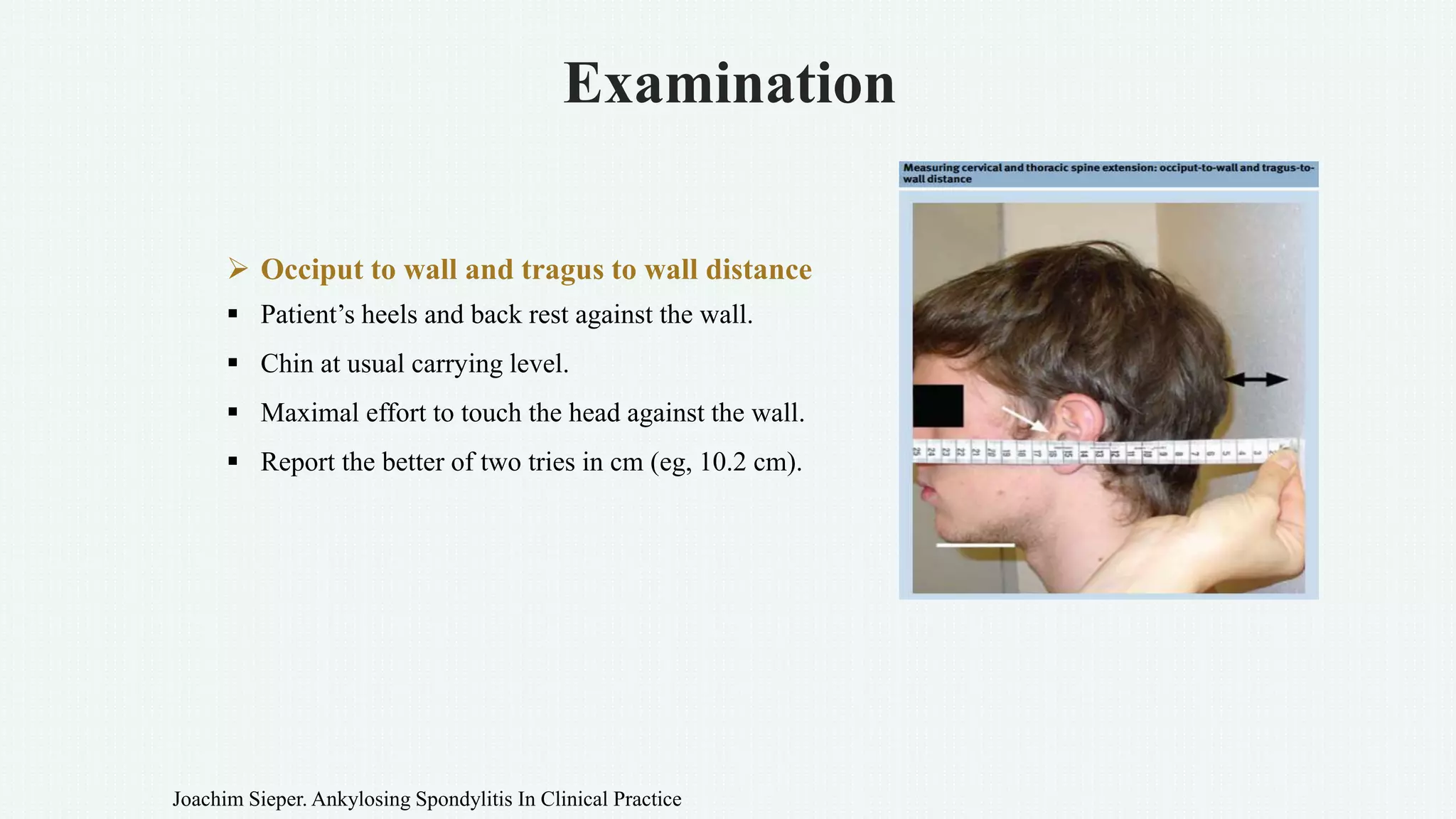 Ankylosing Spondylosis PPT.pptx