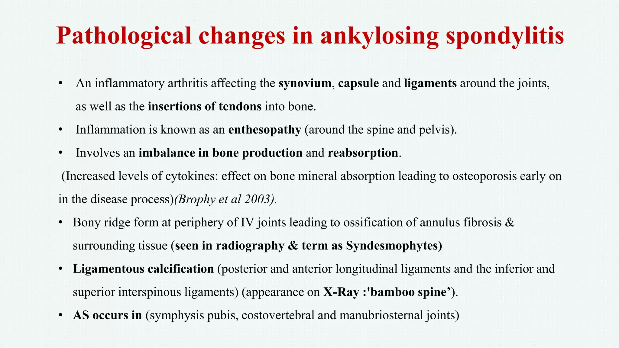 Ankylosing Spondylosis PPT.pptx