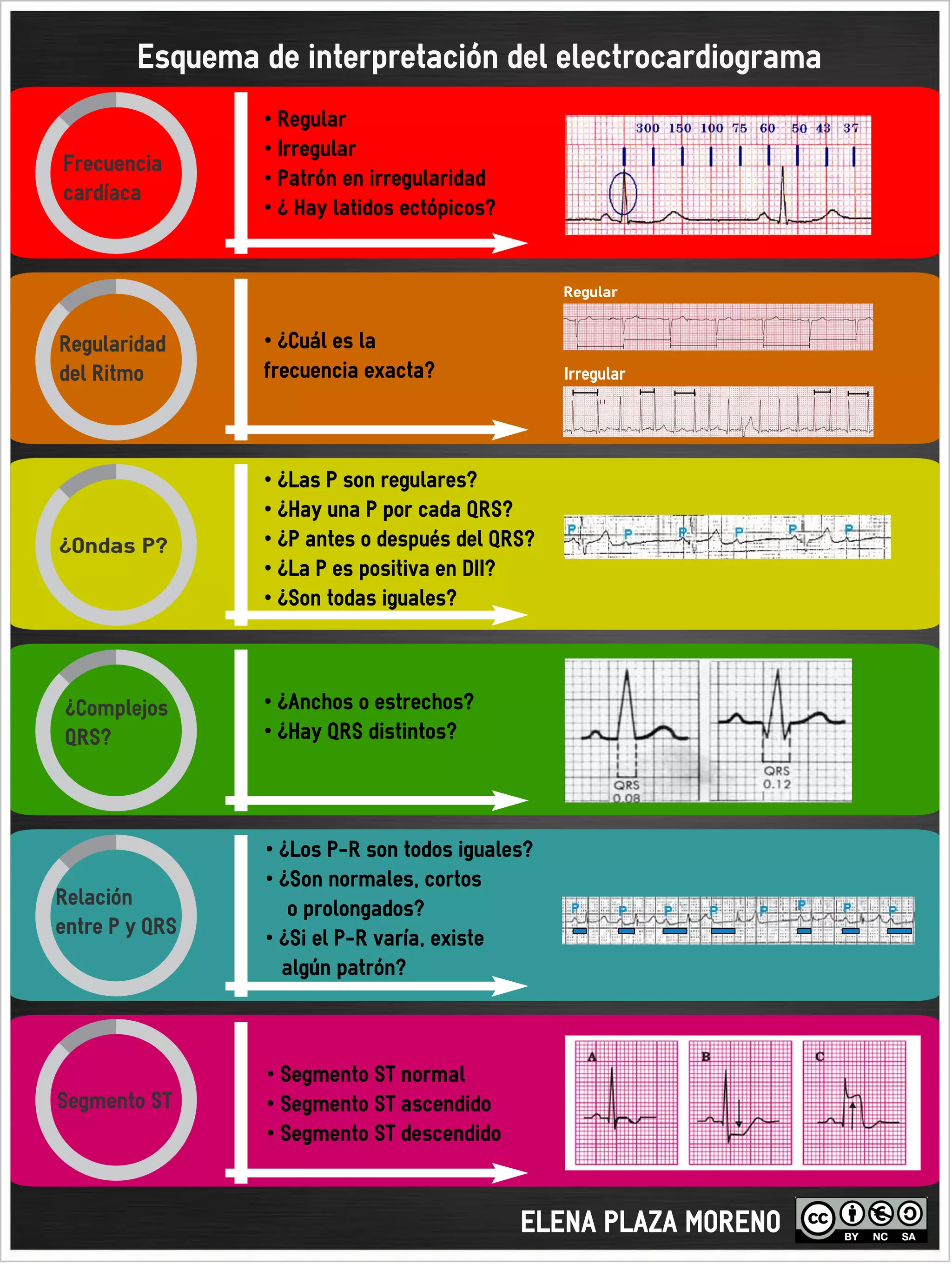 Esquema de interpretación del electrocardiograma | PDF