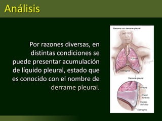 Análisis de líquido pleural | PPTX