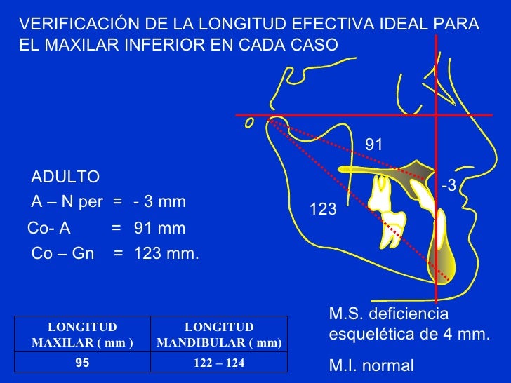Análisis de mc namara