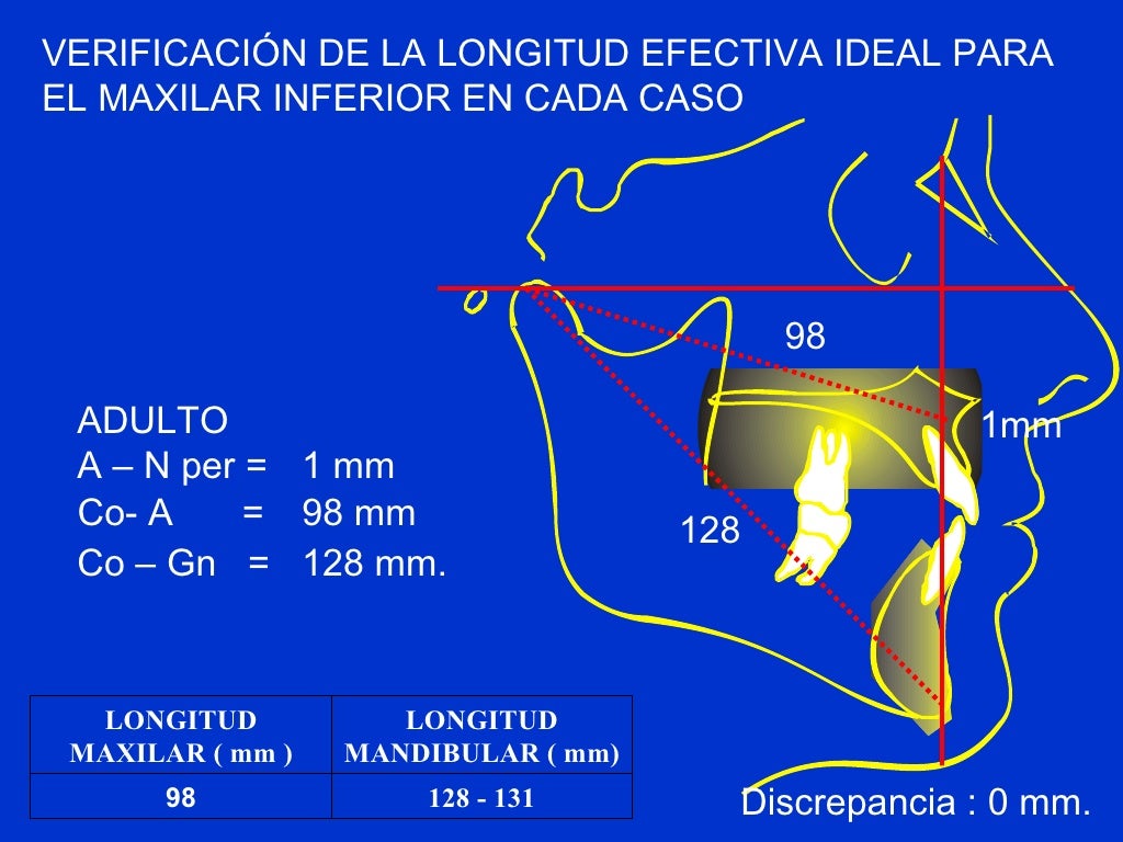 Análisis de mc namara