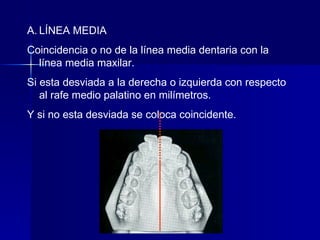 Análisis de modelos | PPT