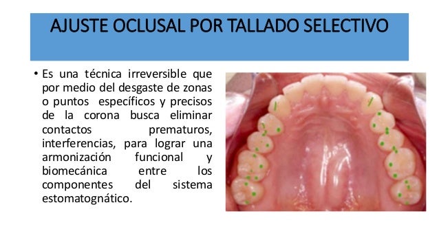Análisis oclusal y diagnostico en la practica periodontal