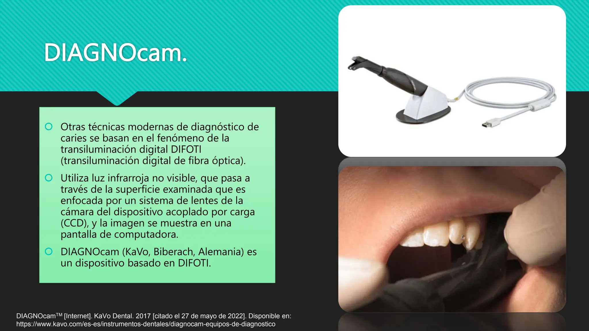 Eficacia diagnóstica del método de fluorescencia inducida por luz y ...