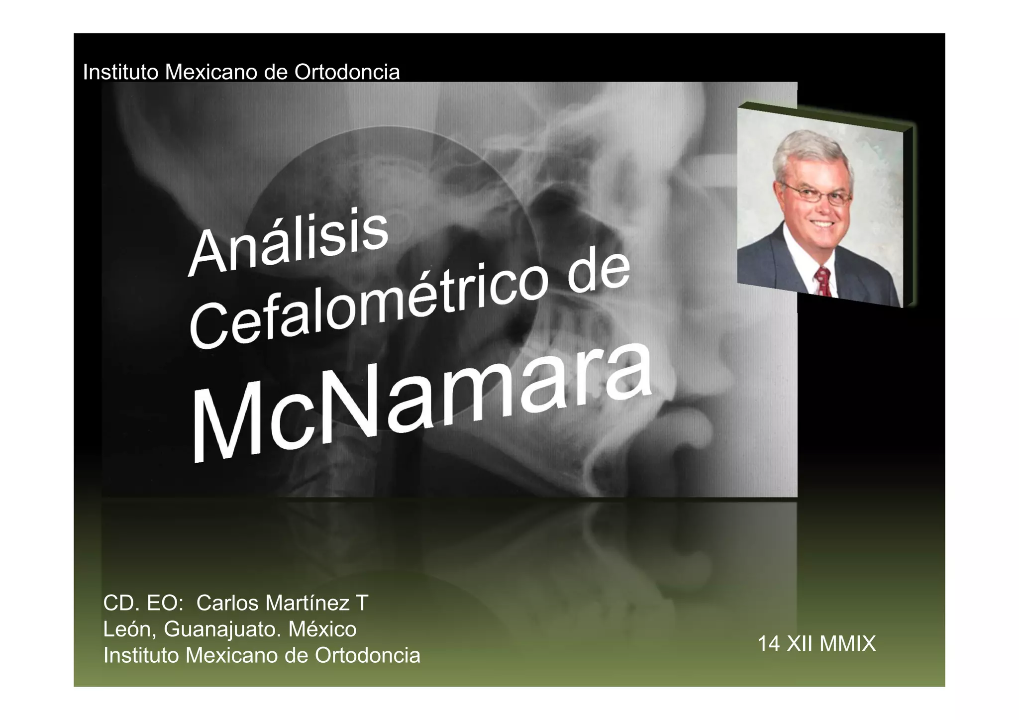 CEFALOMETRIA DE MCNAMARA | PDF