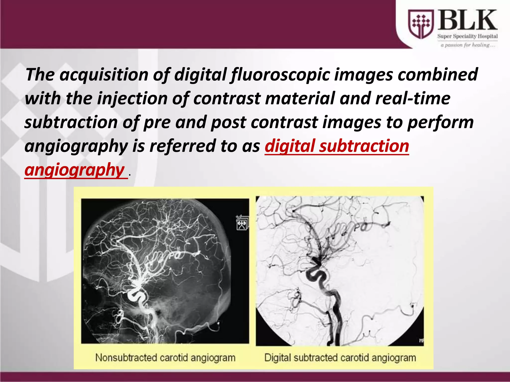Vascular Interventions and their Clinical Applications | PPTX