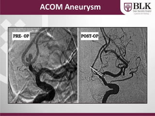 Vascular Interventions and their Clinical Applications | PPTX