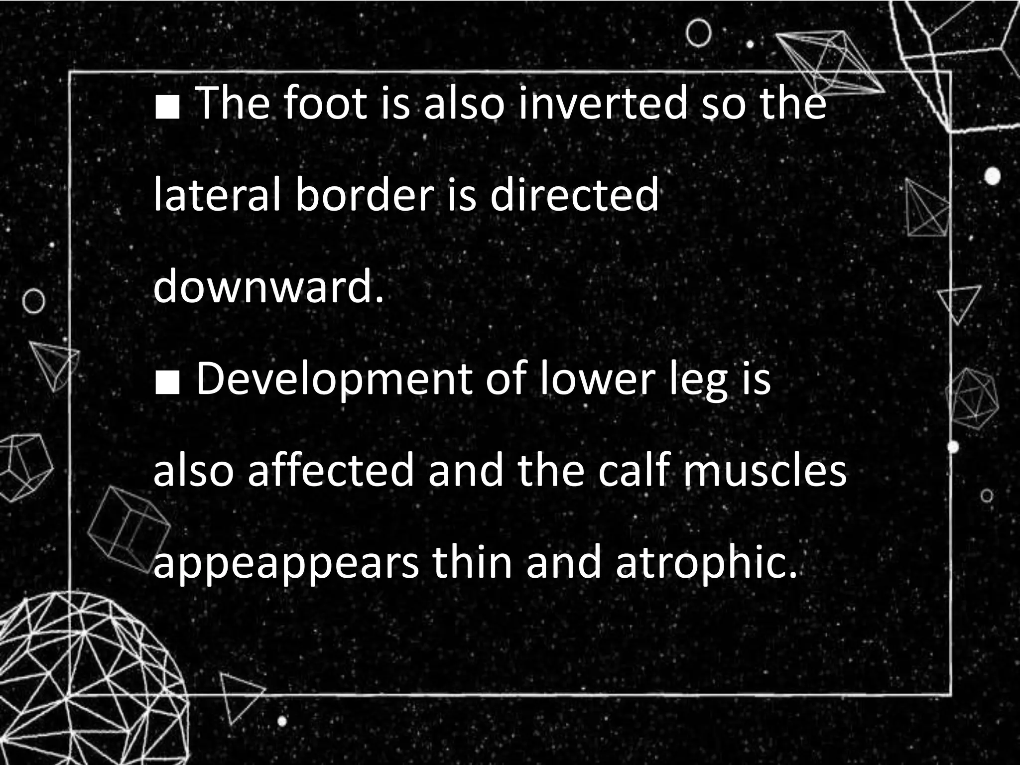 Anna Mariya Kuriakose....Clubfoot Final.pptx
