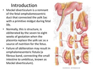 Meckel Diverticulum