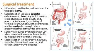 Inflammatory Bowel Disease | PPTX
