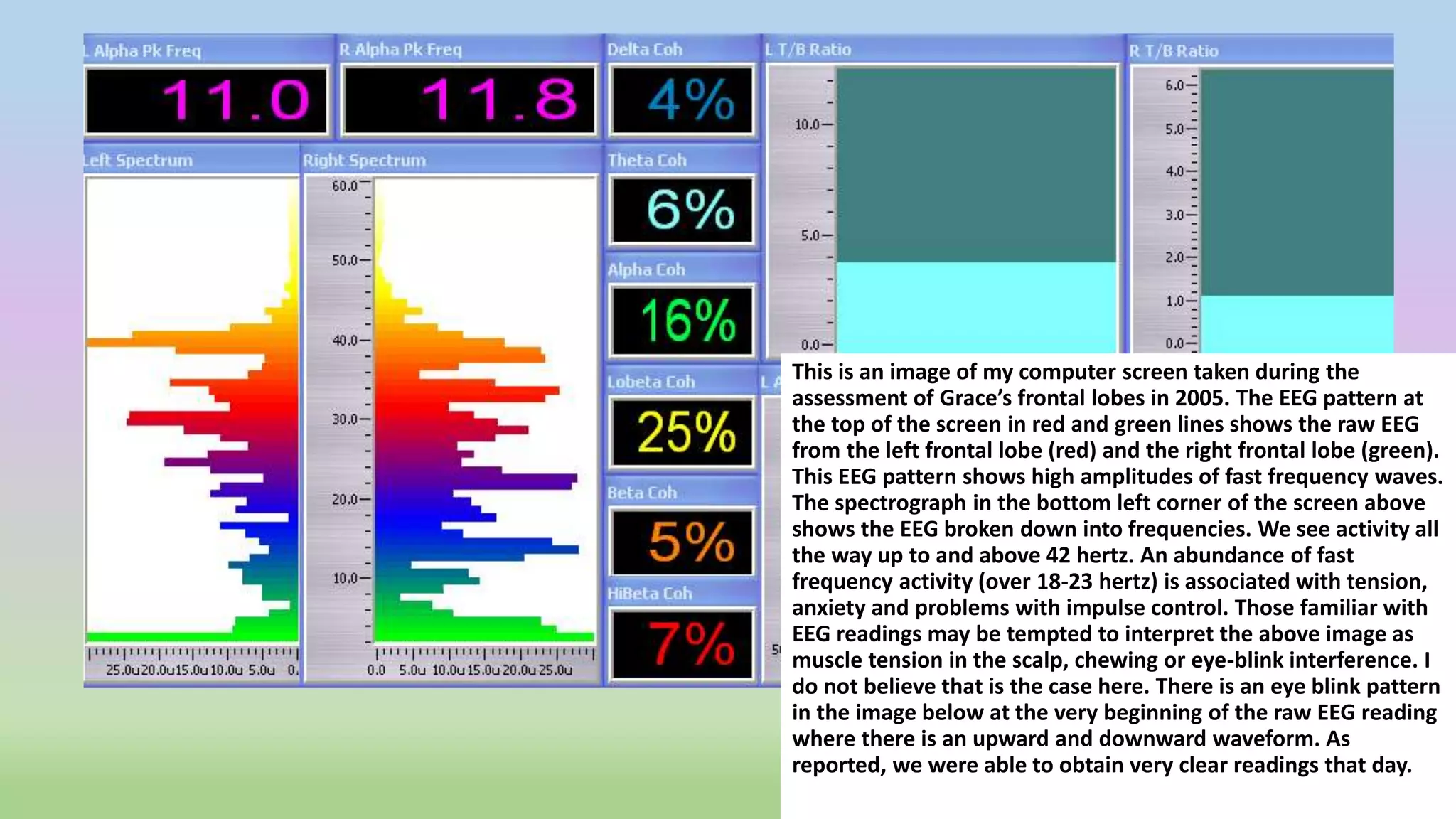 Anna Wise and Linda Tellington-Jones EEG Study with Horses and Humans ...
