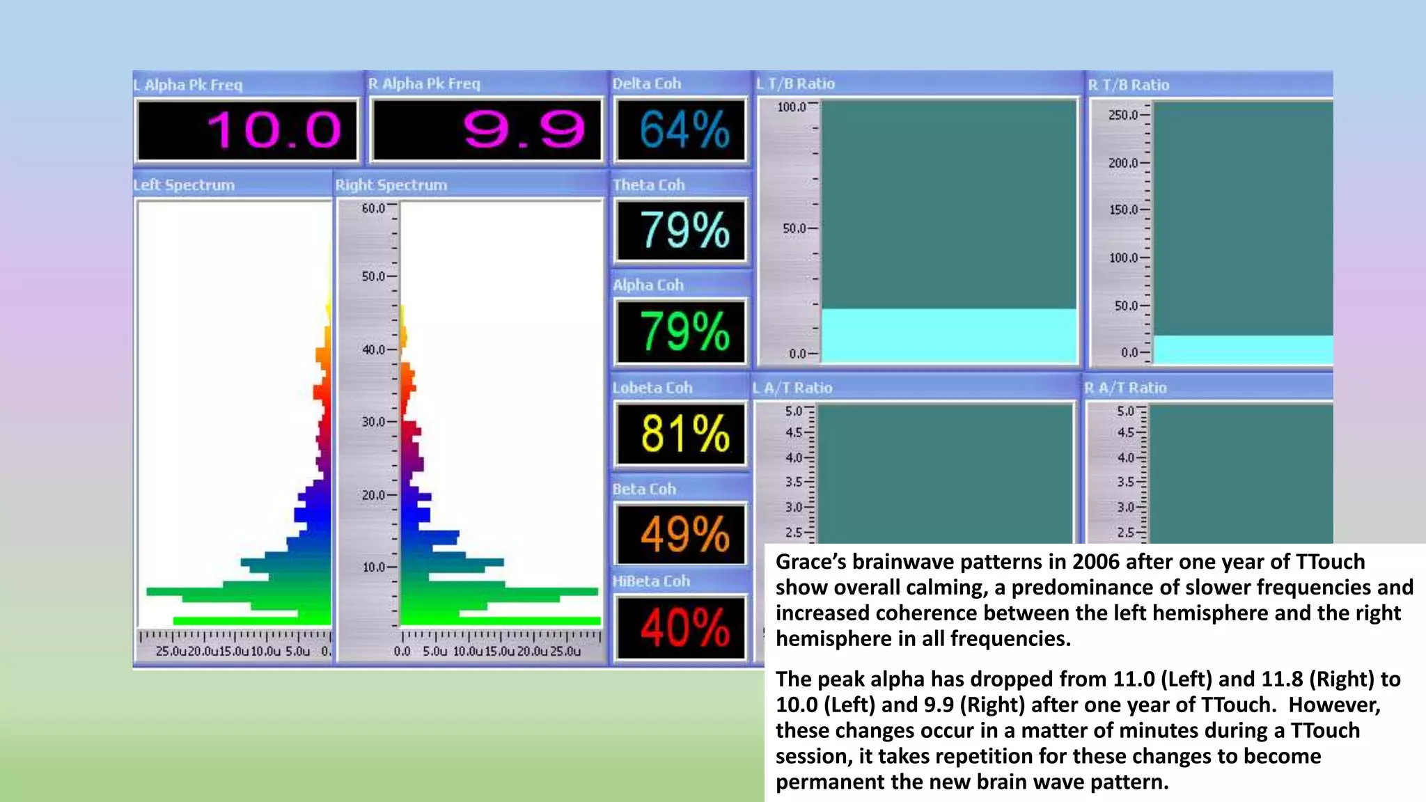 Anna Wise and Linda Tellington-Jones EEG Study with Horses and Humans ...