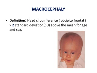 Annormalities of head size and shape | PPTX
