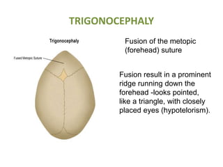 Annormalities of head size and shape | PPTX