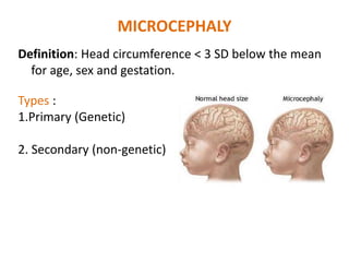Annormalities of head size and shape | PPTX