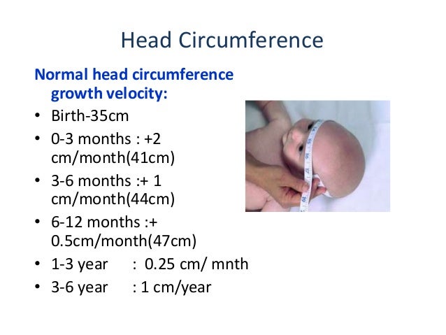 Annormalities of head size and shape