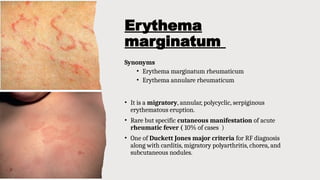 Annular erythema .Annular erythema is a descriptive term that ...