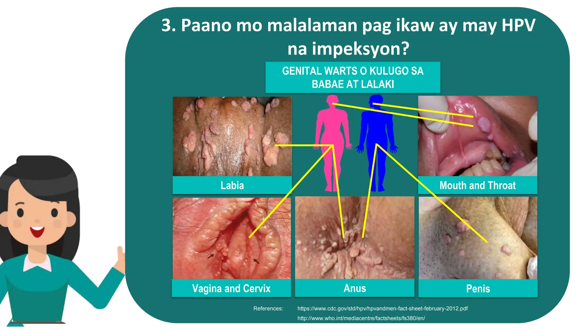Ano-ang-HPV-at-mga-Sakit-na-Naidudulot-nito-UPDATED.pptx