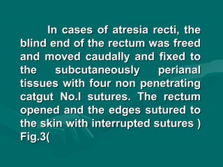 Ano rectal affections | PPT