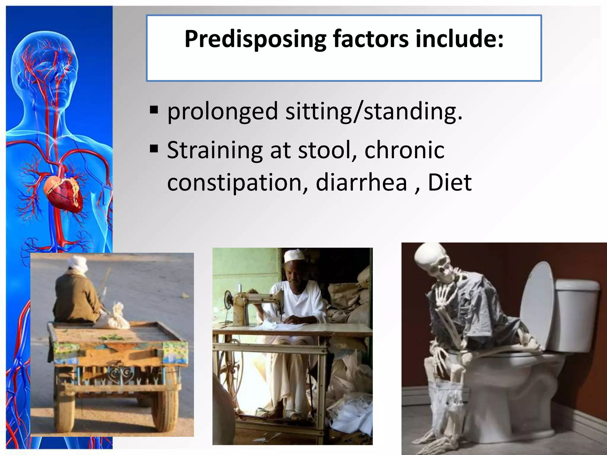 Ano rectal conditions | PPTX