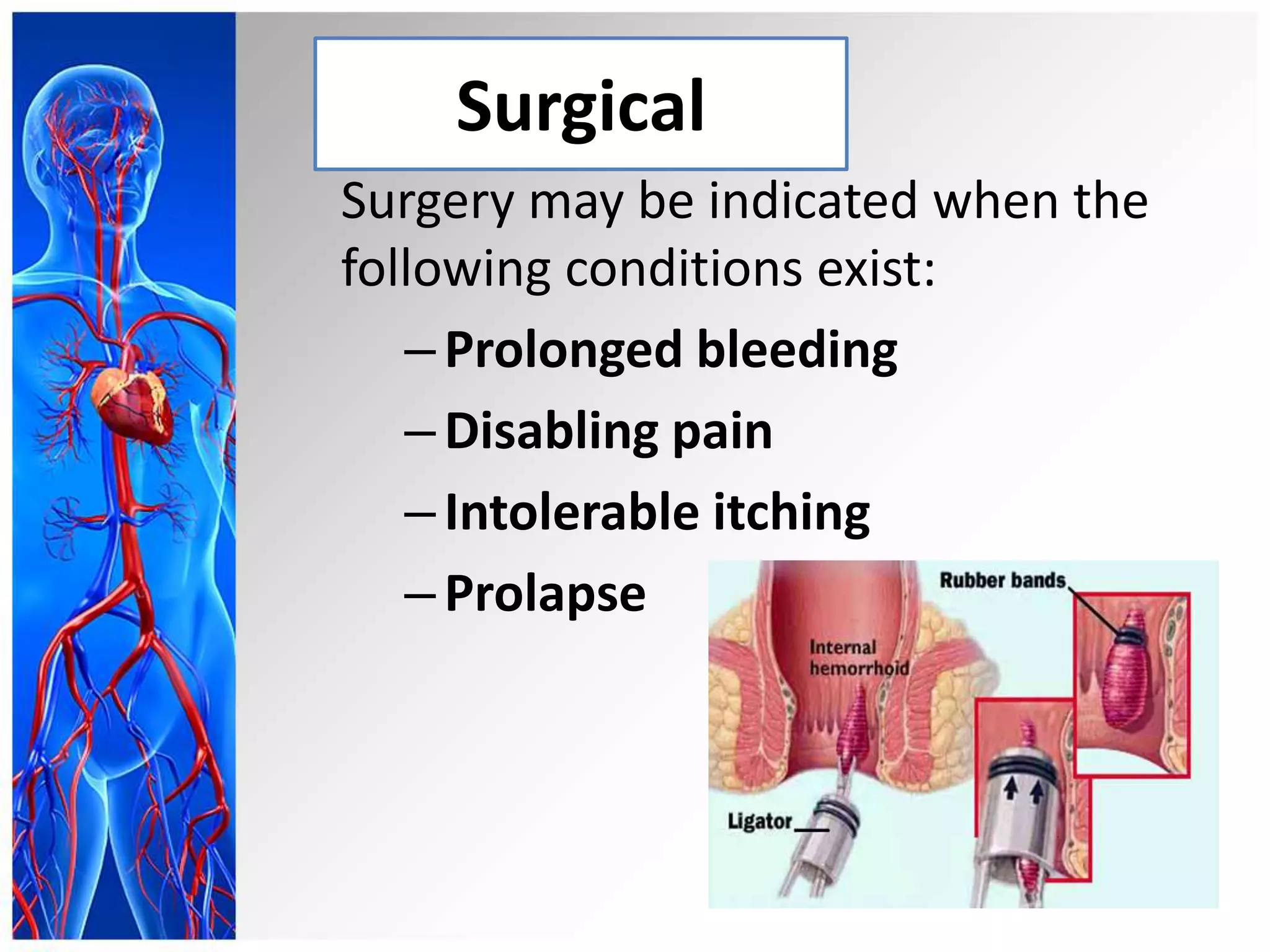 Ano rectal conditions | PPTX