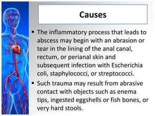 Ano rectal conditions | PPTX