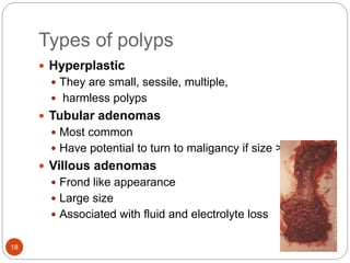 Rectal diseases | PPTX