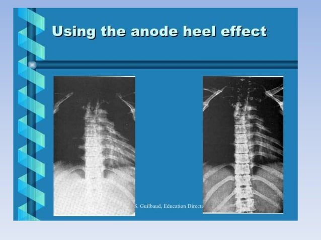 Anode heel effect, line focus principle, | PPTX | Chemistry | Science