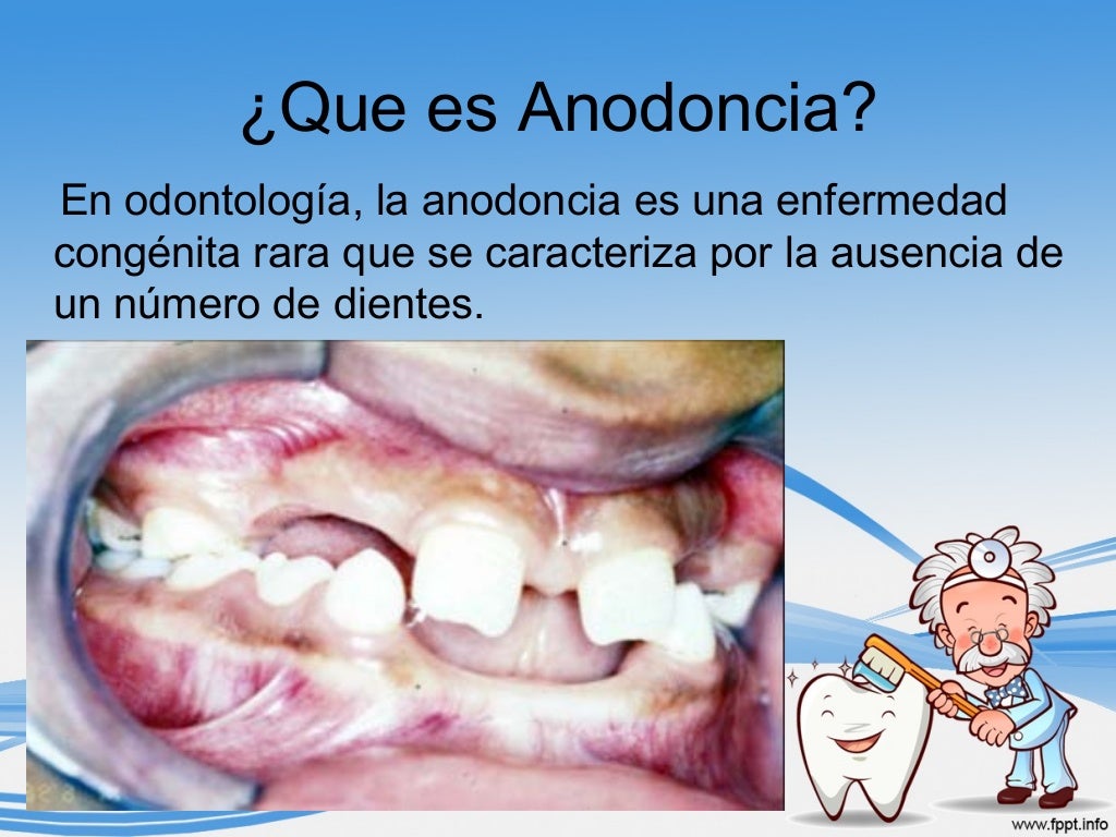 Anodoncia