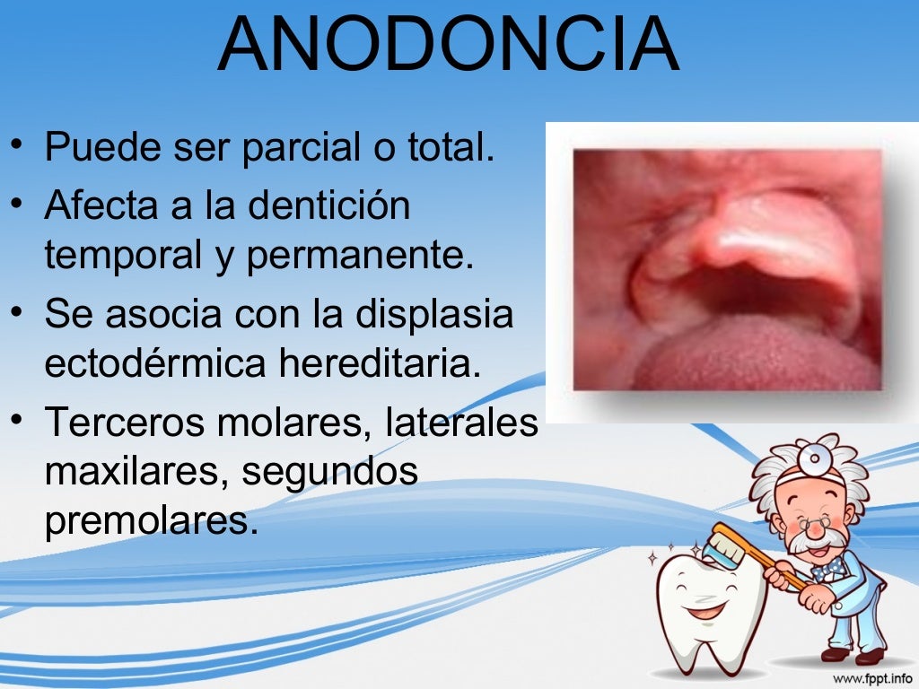 Anodoncia