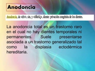 Anodoncia | PPTX