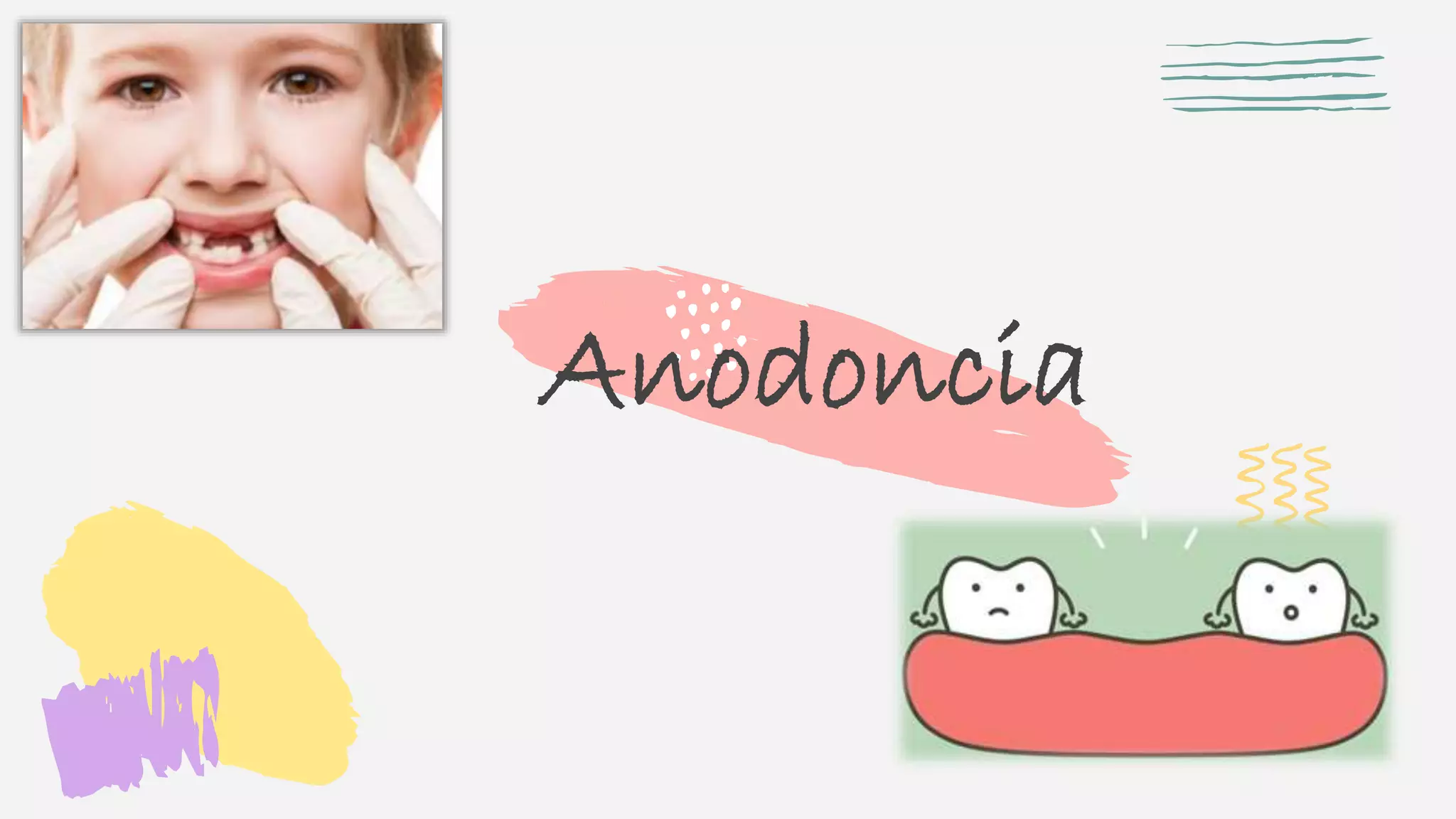 Anodoncia .pptx