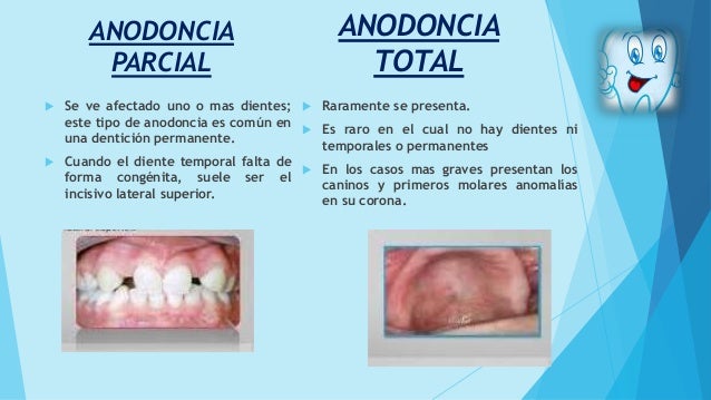 ANOMALIAS DENTALES