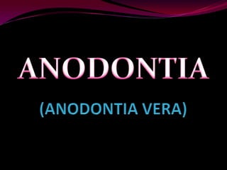 Anodontia | PPTX
