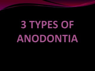 Anodontia | PPTX | Dental Health | Diseases and Conditions