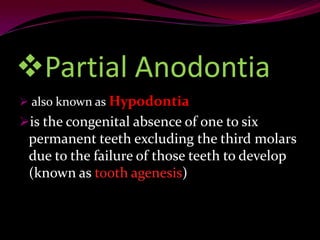 Anodontia | PPTX