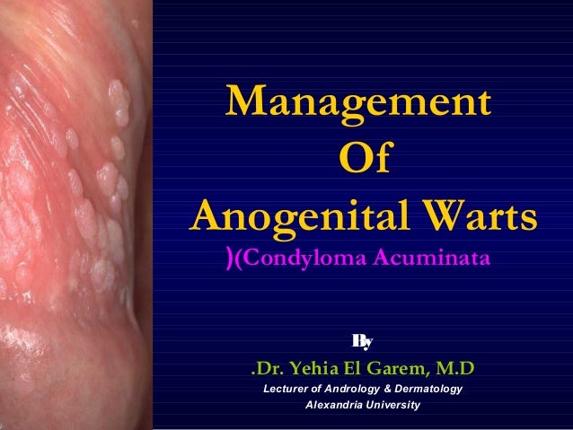 Anogeneital warts