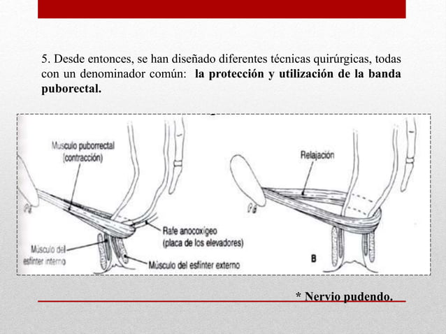 Ano Imperforado Externado de Cirugia USAC | PPT