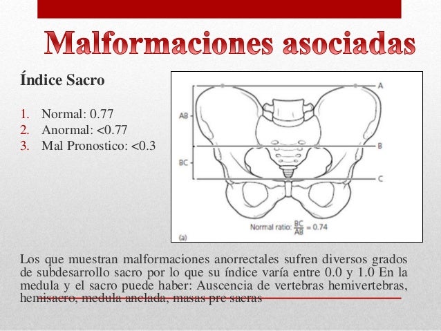 Ano Imperforado Externado de Cirugia USAC
