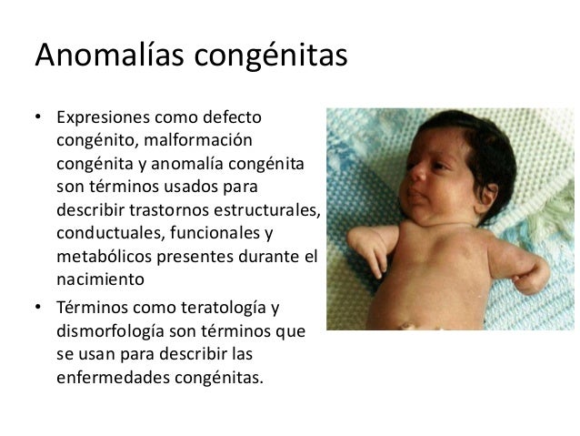¿Qué Son Las Anomalías Congénitas De La Columna Vertebral? – IFBJG