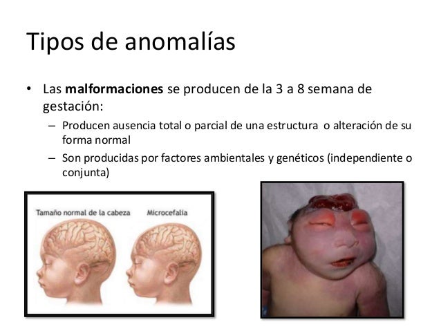 Anomalías congénitas y diagnostico prenatal
