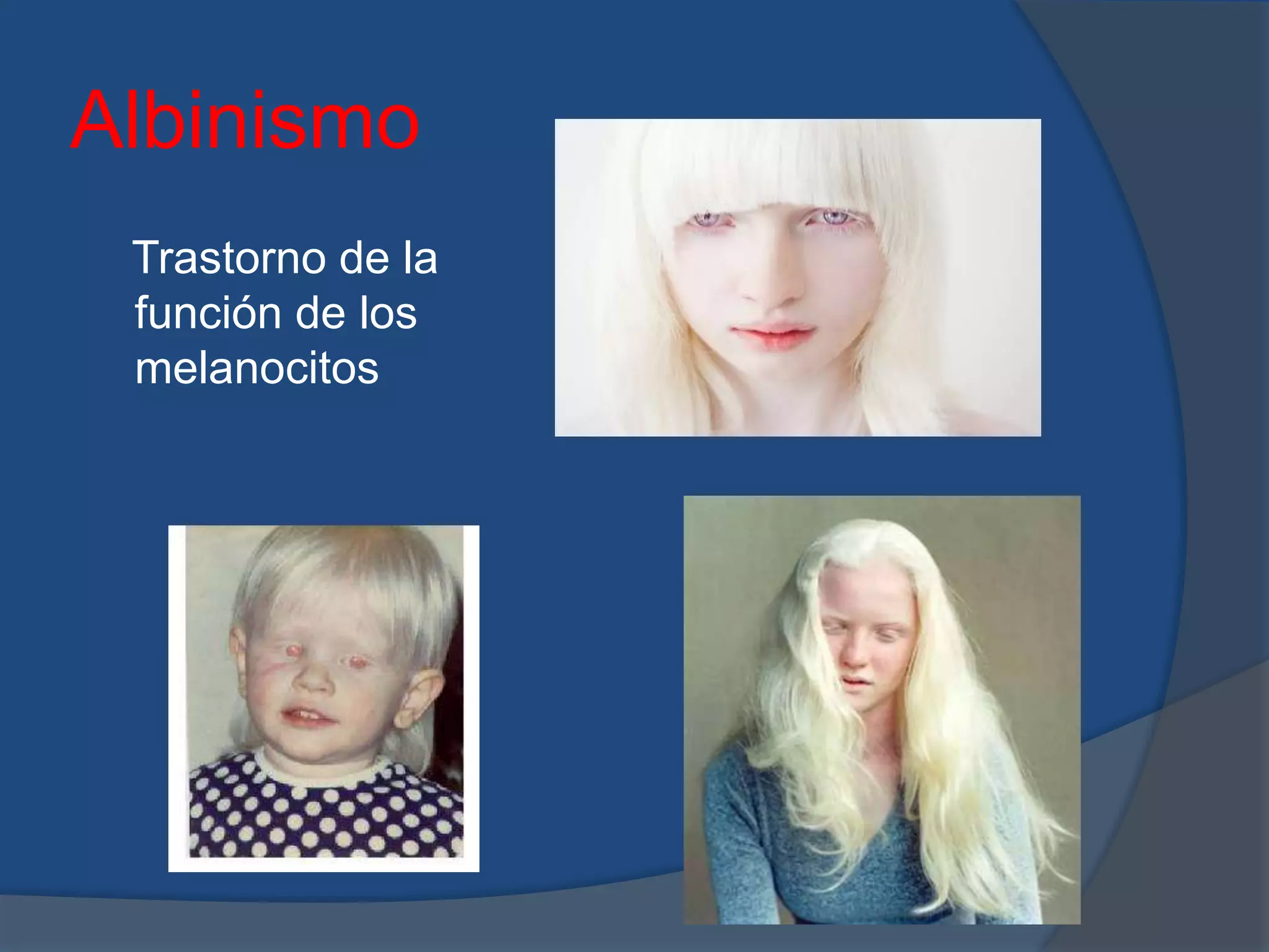 Anomalías congenitas de la piel | PPTX