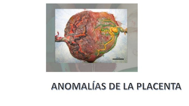 Anomalías de la placenta, el cordón umbilical y memrbranas.