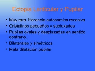 Anomalias Del Cristalino 1 Adrian | PPT