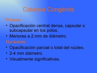 Anomalias Del Cristalino 1 Adrian | PPT