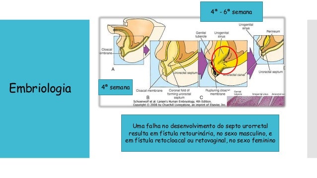 Anomalias anorretais