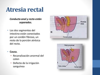 Anomalías del Aparato Digestivo - Embriología | PPTX